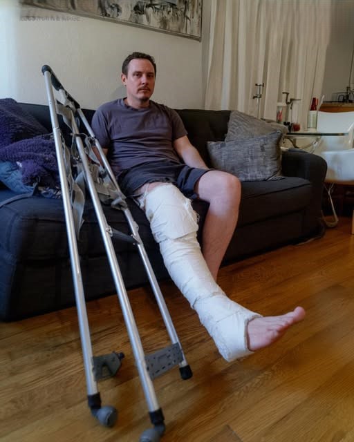 My Husband Showed Up with a Cast on His Leg the Day Before Our First ...